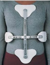 Fracture Bracing | Cash Brace | Sarmiento Brace | Wrist Brace ...