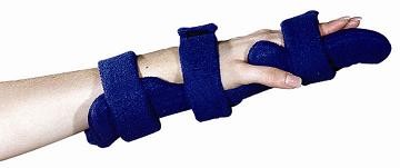Wrist Orthosis | Hand Splint | Hand Orthosis | Custom Orthotics | Orthosis